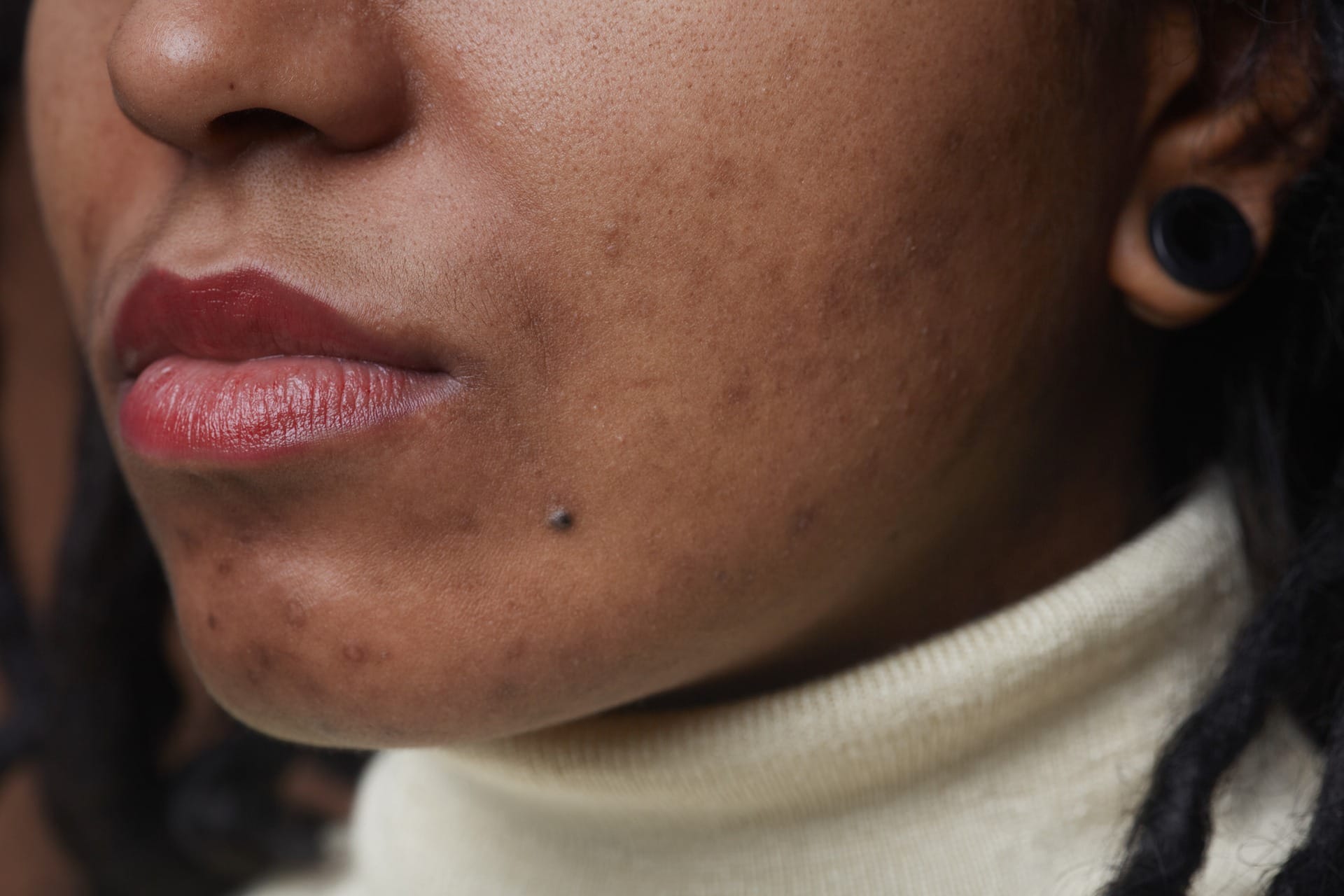 Skin Pigmentation Symptoms: Causes, Types, and Disease Links