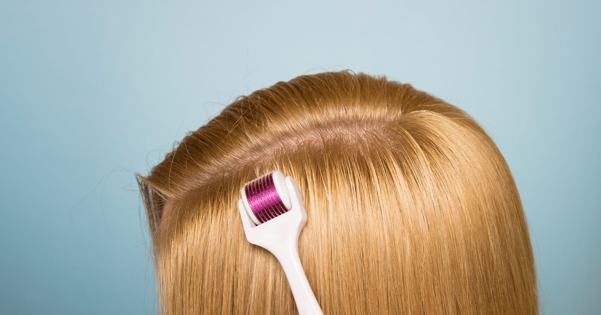 Does Derma Roller Work for Hair Growth? Truth & Benefits Explained