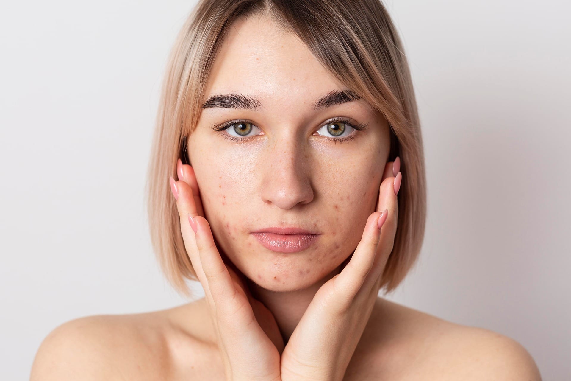 What Is Pigmentation on Face and What Causes It?