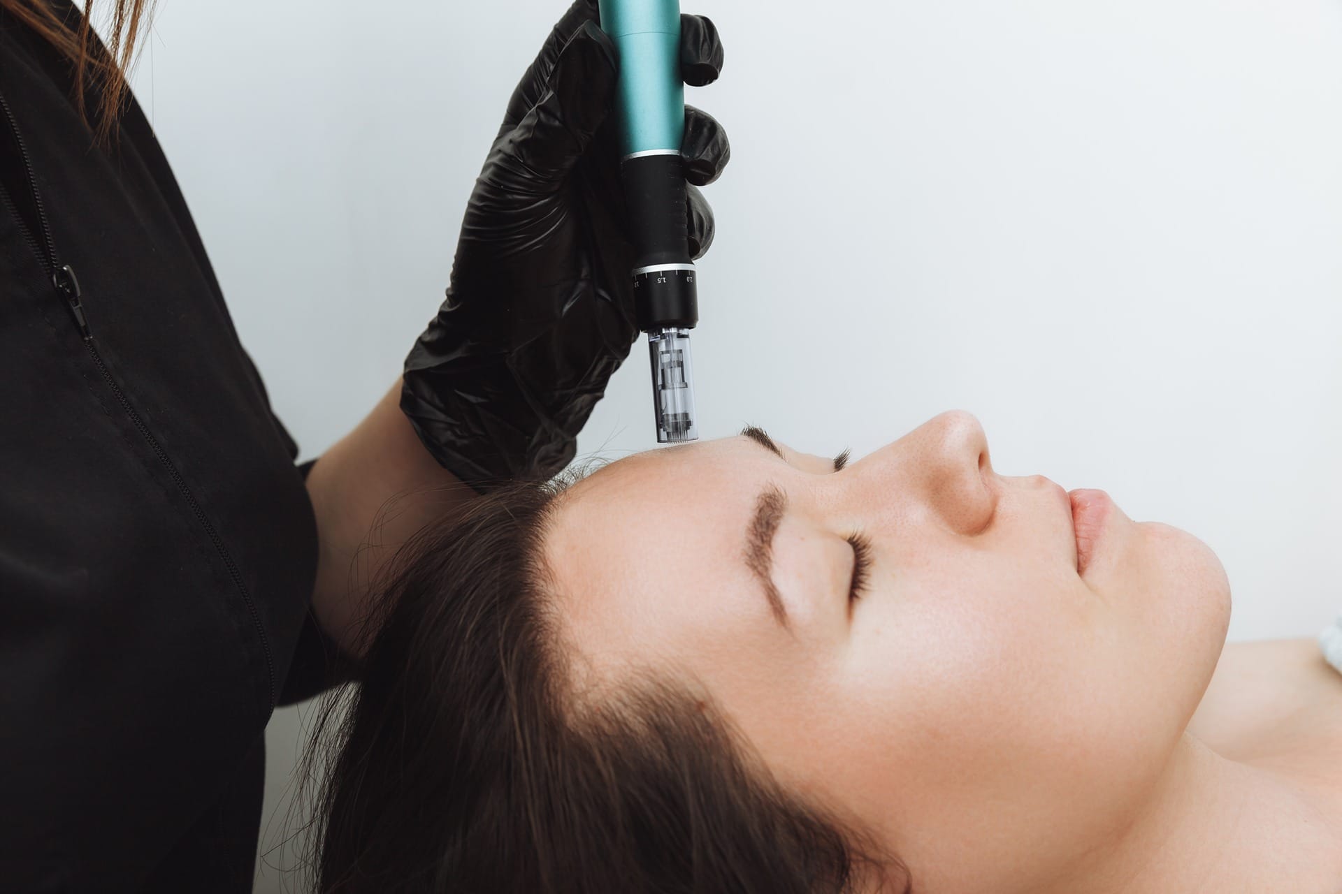 What Is Mesotherapy? Meaning, Benefits & Side Effects