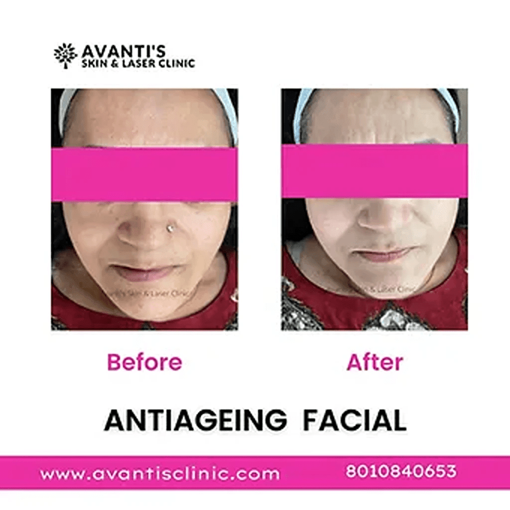 Glutathione for Skin Lightening: What It Can and Cannot Do