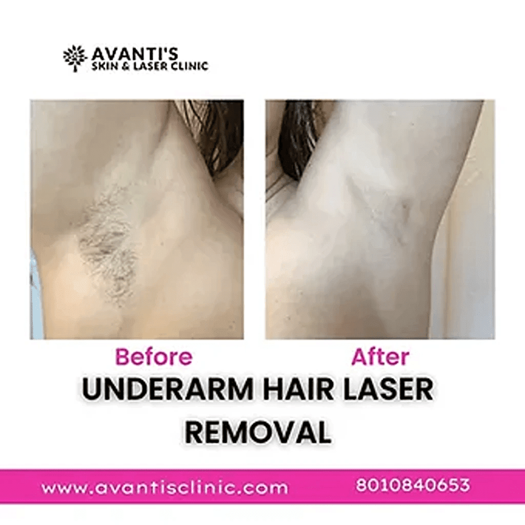 Glutathione for Skin Lightening: What It Can and Cannot Do